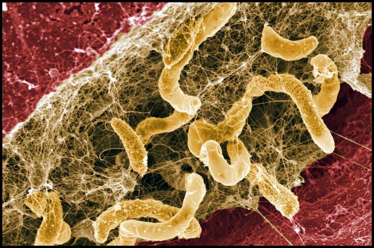 Acute Syphilis . . . Re-thinking the Mass Killers of Indigenous America ...